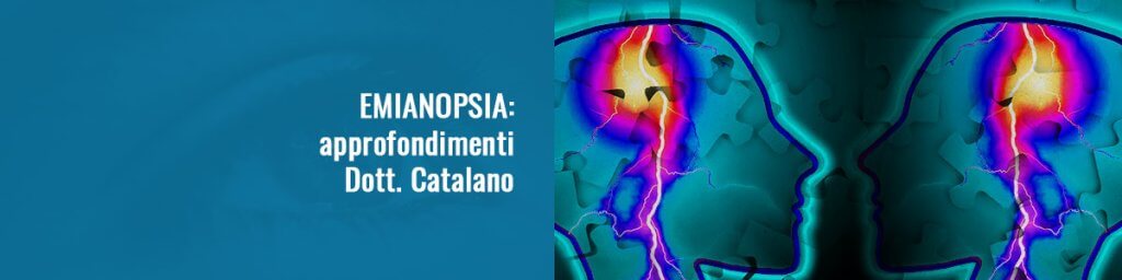 Emianopsia: cause e caratteristiche di questo deficit visivo - Emianopsia