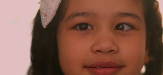 Visual disability - Emianopsia